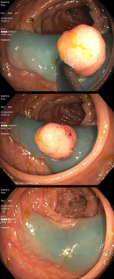 Retroflexions.com » There were no survivors. [Warning: GRAPHIC]